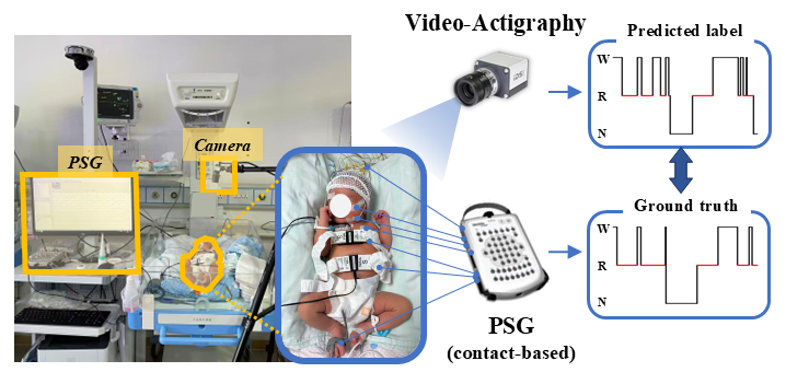 Contactless Smart Infant Sleep Monitoring System | CV_YIMING_ZHONG